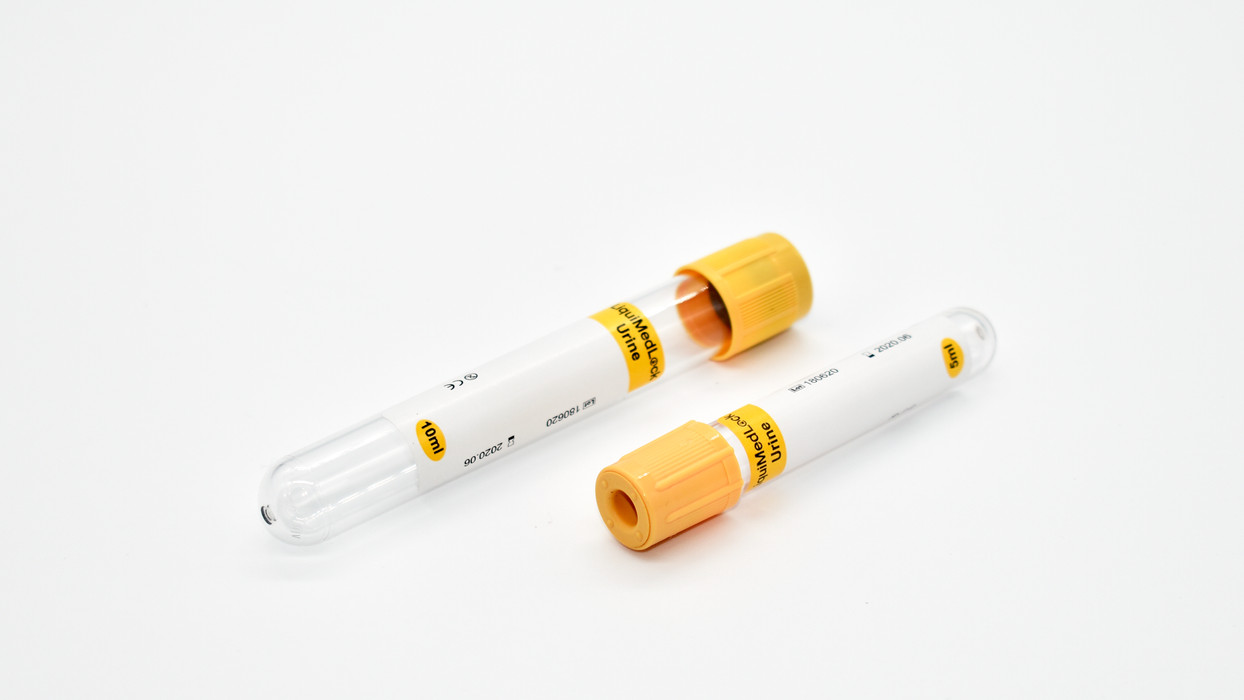 Vacuum Collection Tubes – Hygienic & Reliable