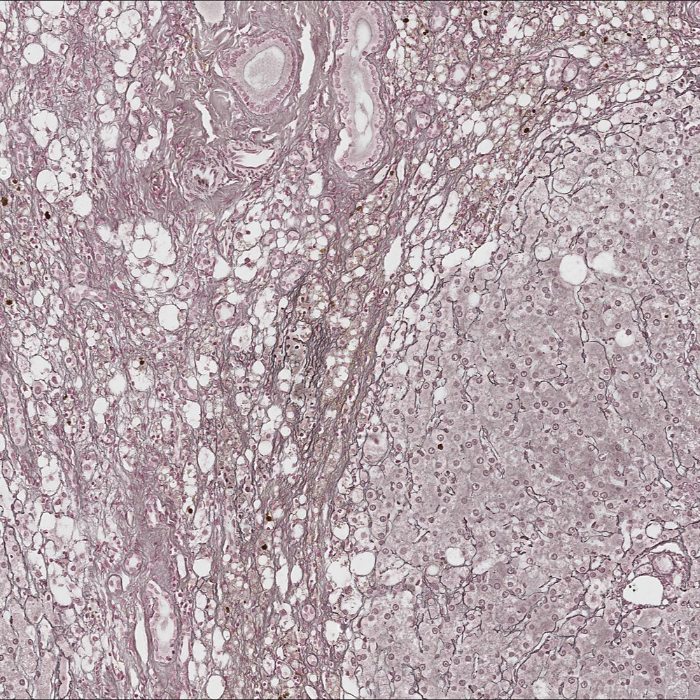 What is a 'liver panel' of histochemical special stains, and why is it ...