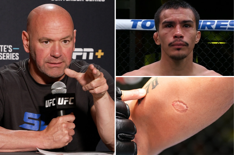 Dana White AXES Igor Severino from UFC for Biting Incident