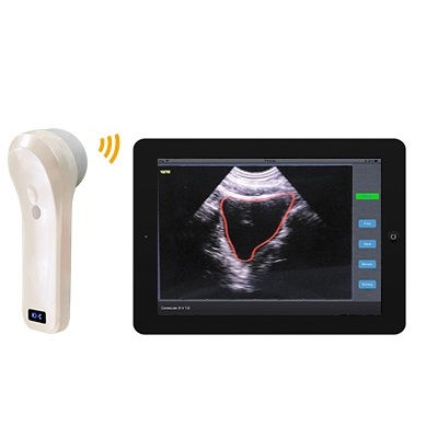 Wireless 4D Bladder Scanner