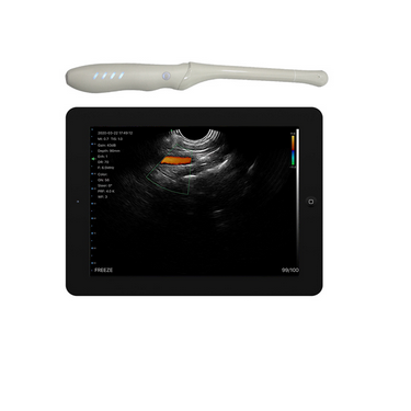 Wireless Ultrasound Probe 4T - Transvaginal