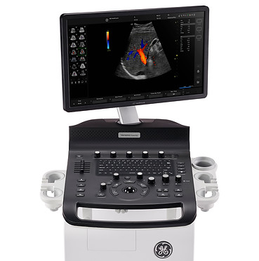 GE Versana Ultrasound | GE Ultrasound | Standard Ultrasound