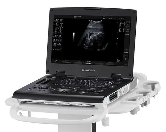 GE Versana Ultrasound | GE Ultrasound | Standard Ultrasound
