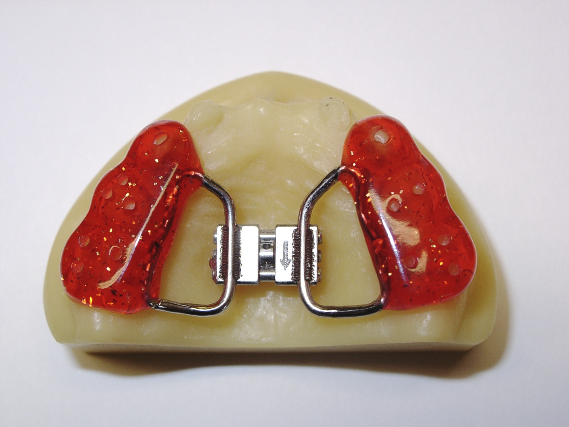 Kinderzahnheilkunde KZH Technik | Tessmann KFO Technik | Schwäbisch Hall