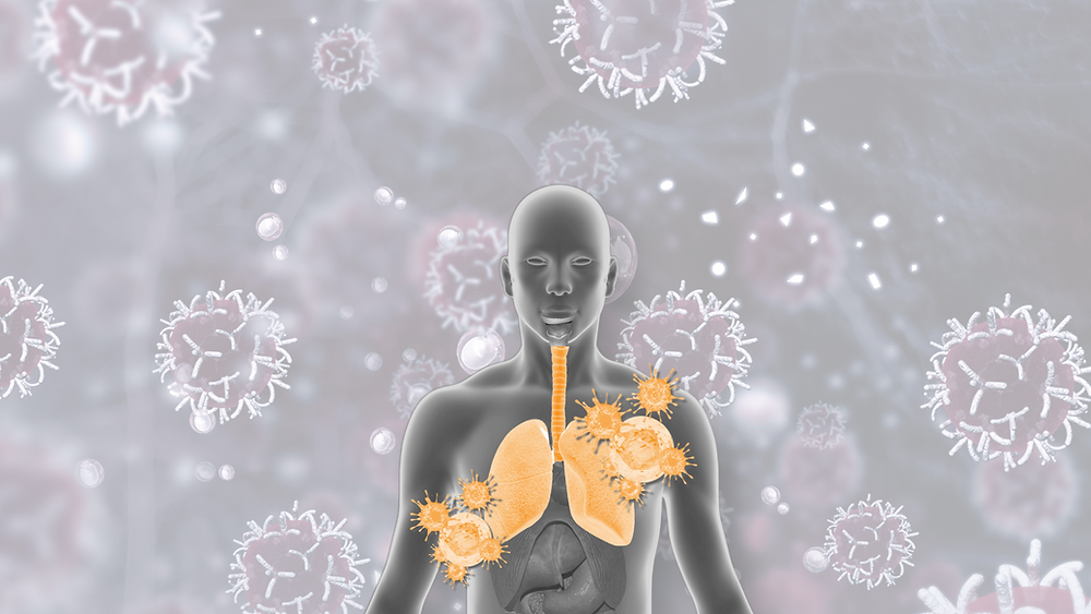 Panel Respiratorio, FilmArray (PCR)