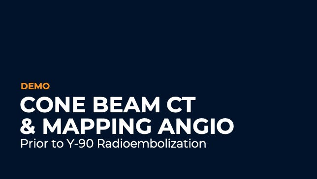 Cone Beam CT & Mapping Angiography Before Y-90 | BackTable Demo