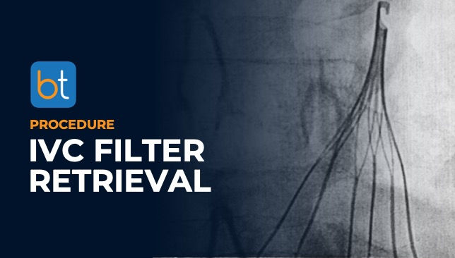 IVC Filter Retrieval Procedure Prep | BackTable VI