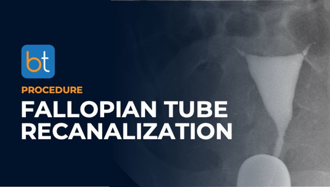 Fallopian Tube Recanalization Procedure | BackTable VI
