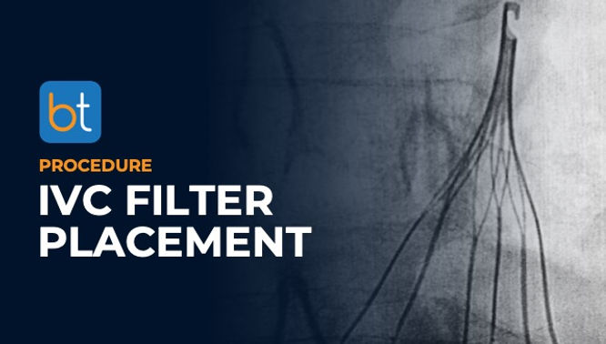Ivc Filter Placement Procedure Steps Backtable Vi