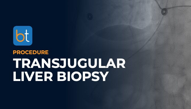 Transjugular Liver Biopsy Procedure | BackTable VI