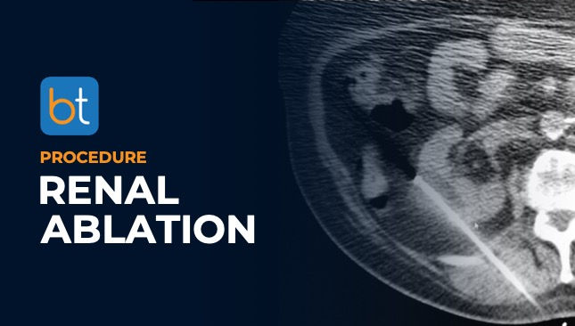 Renal Ablation Procedure Prep | BackTable VI