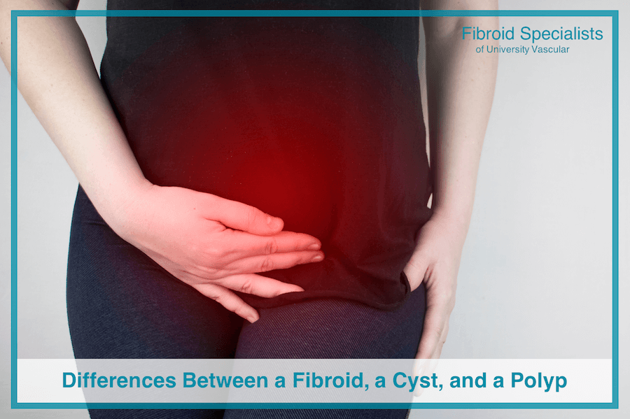 Differences Between A Fibroid, Cyst, & Polyp | Fibroid Specialists