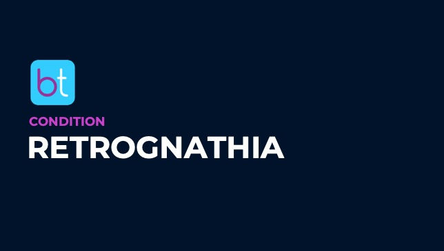 Retrognathia Condition Overview | BackTable ENT