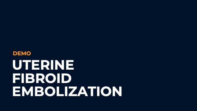 Watch a Uterine Fibroid Embolization (UFE) Procedure | BackTable Demo