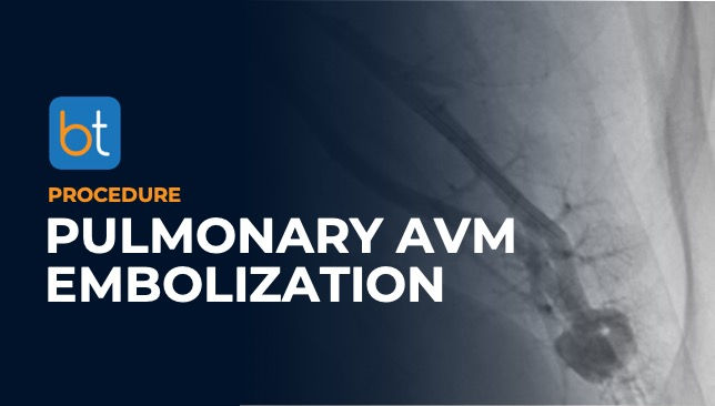 Pulmonary AVM Embolization Procedure Prep | BackTable VI