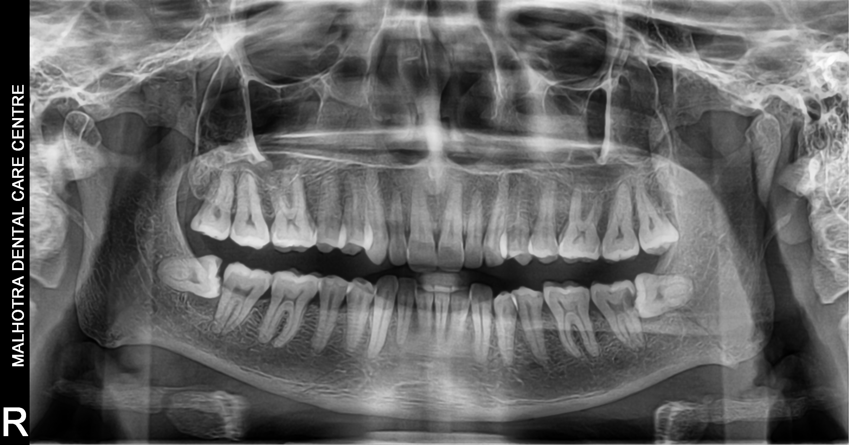 The Smiles Dental, Raub