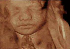 2D 3D 4D Ultrasound | First Glance 4D Studio | Akron