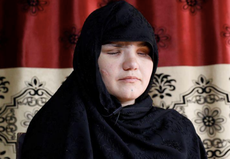 A 33-year-old Afghan woman, Khatera, was shot, stabbed and blinded, for ...