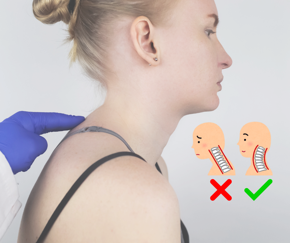 Understanding and Addressing Dowager's Hump: Causes, Prevention, and ...