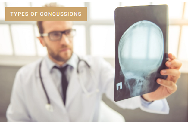 Everything You Need To Know About Different Types of Concussions