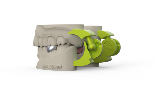 Printable Articulator - xSnap | EDOS