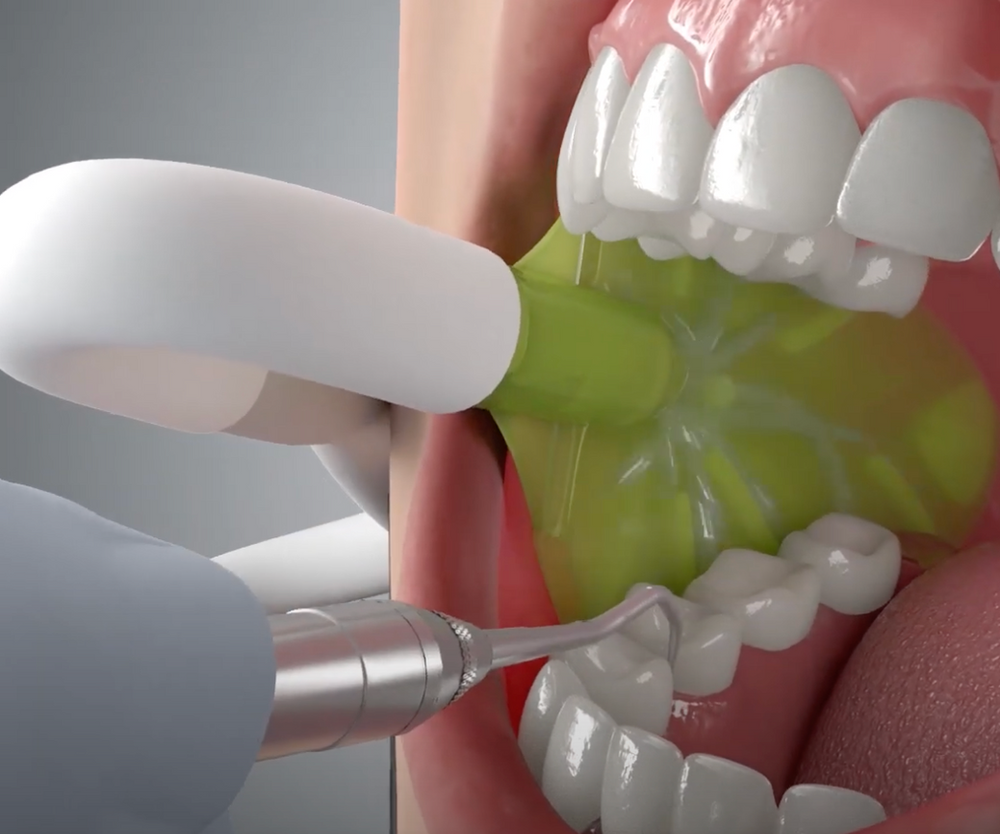 You Can Breathe A Little Easier During Your Next Visit