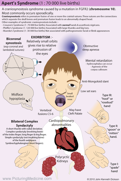 Picturing Medicine :- Syndromes