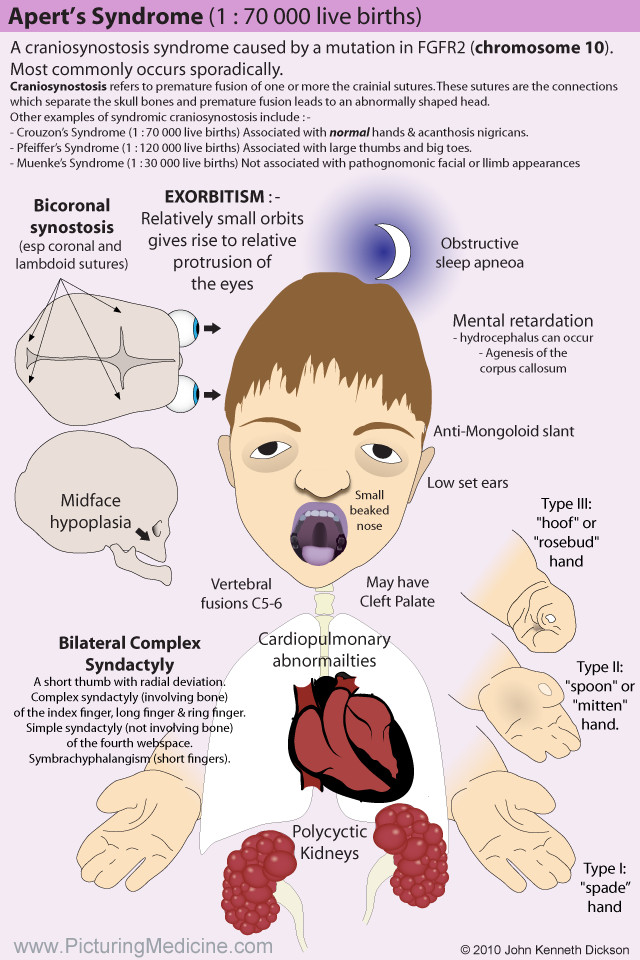 Picturing Medicine :- Syndromes
