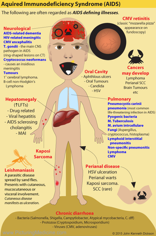 Picturing Medicine :- Signs & Symptoms of Disease