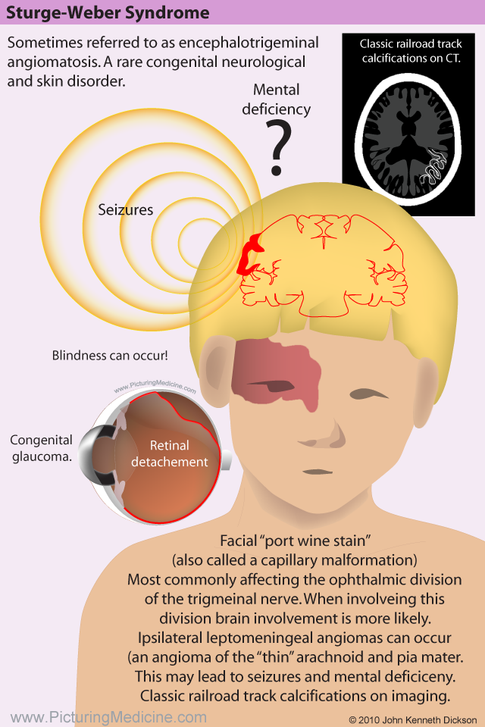 Picturing Medicine :- Syndromes