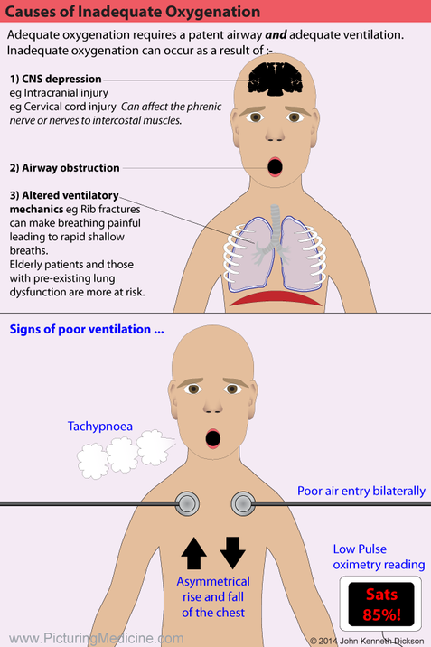 Picturing Medicine :- Trauma