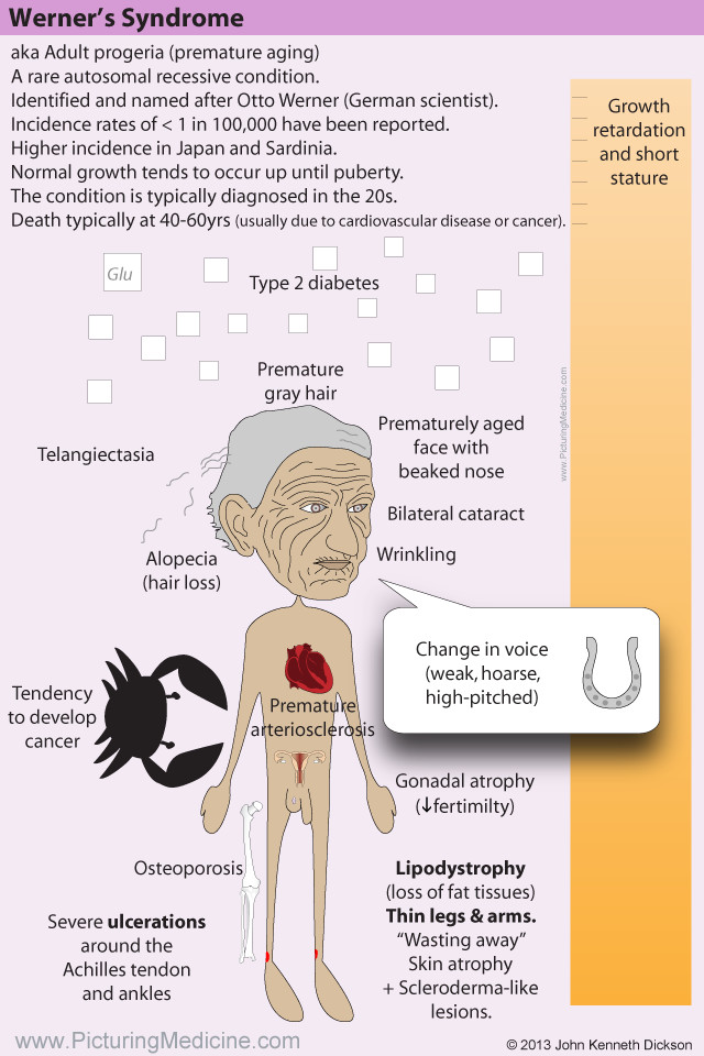 Picturing Medicine :- Syndromes