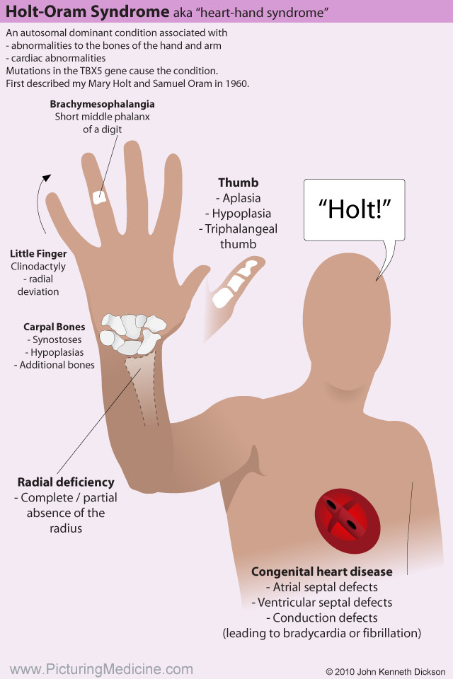Picturing Medicine :- Syndromes