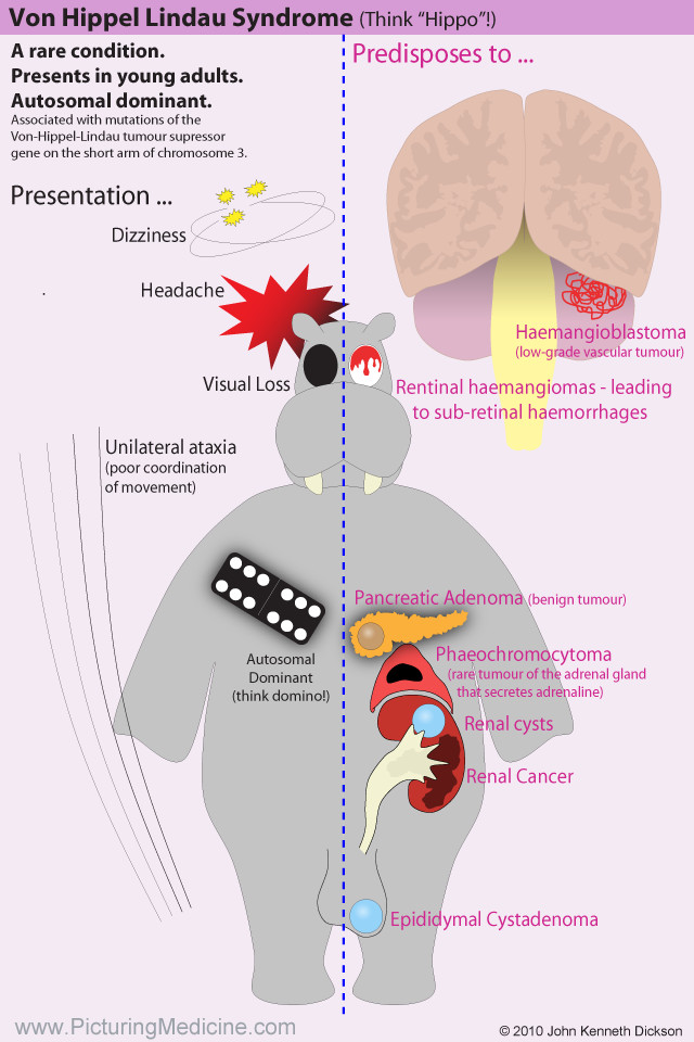 Picturing Medicine :- Syndromes