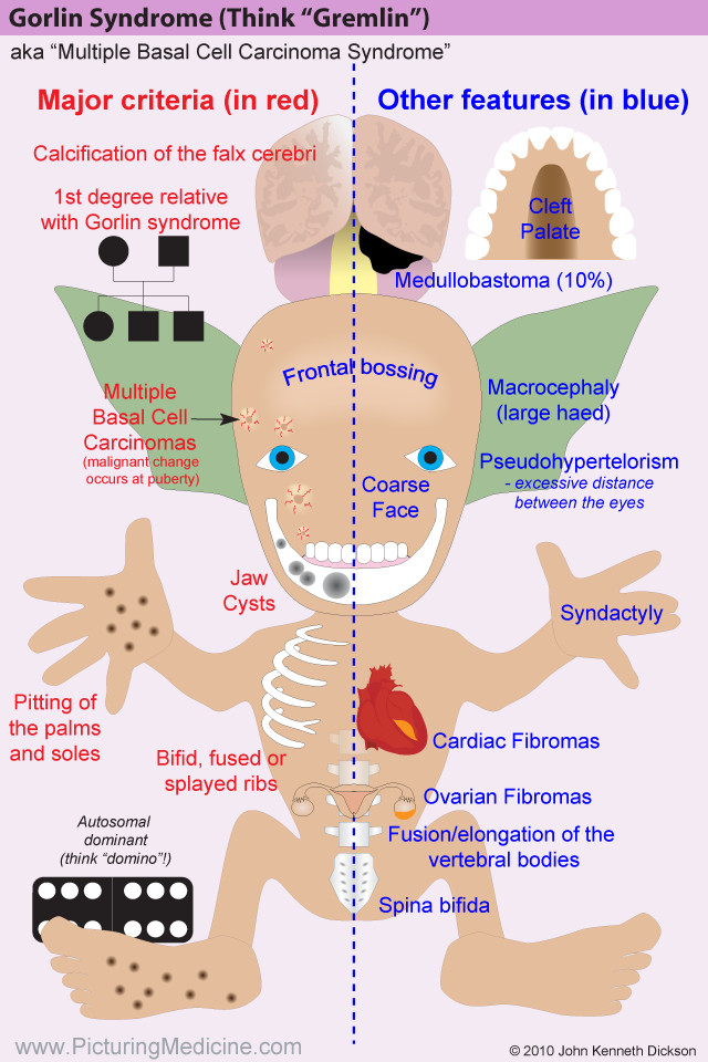 Picturing Medicine :- Syndromes