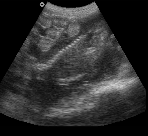 Ultrasound Pregnancy Testing For Sheep