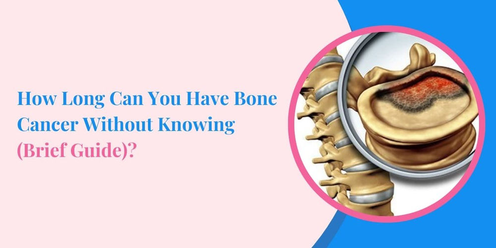 HOW LONG CAN YOU HAVE BONE CANCER WITHOUT KNOWING (BRIEF GUIDE)?