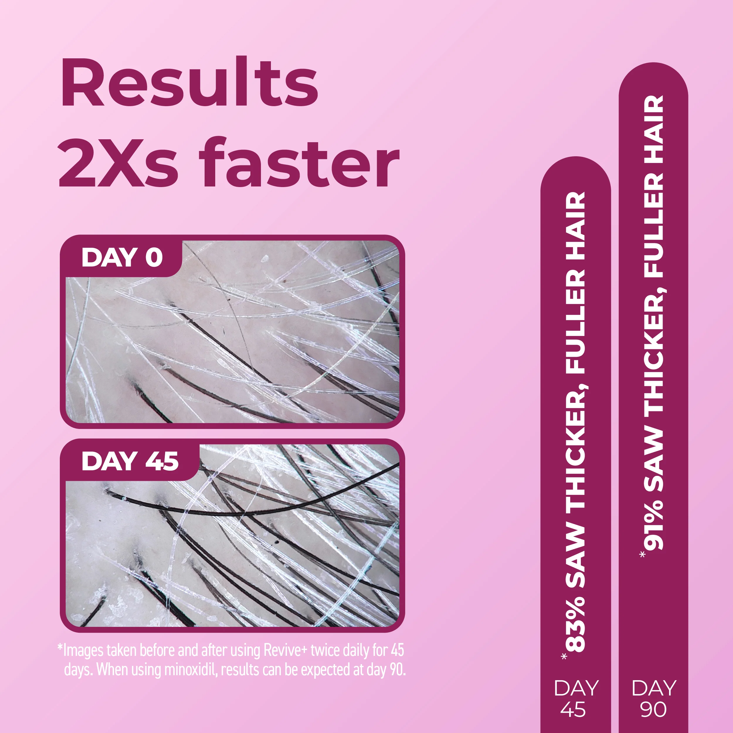 Bosley Revive+ Densifying Foam for Women. Hair Loss Product | Wig Wise