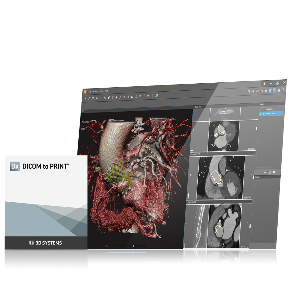 3D Systems D2P (DICOM to PRINT) | 3D Middle East LLC