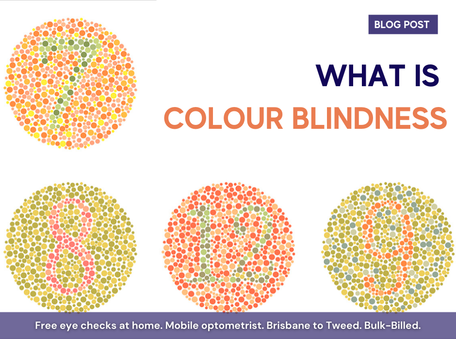 What is Colour Blindness?