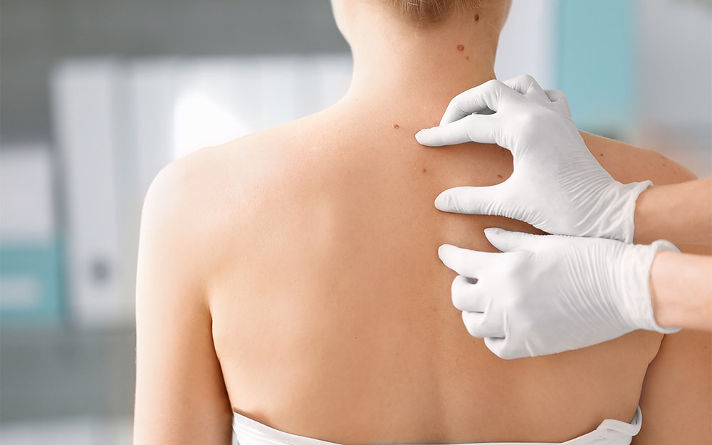 Skin Lumps and Bumps: An A-Z Guide