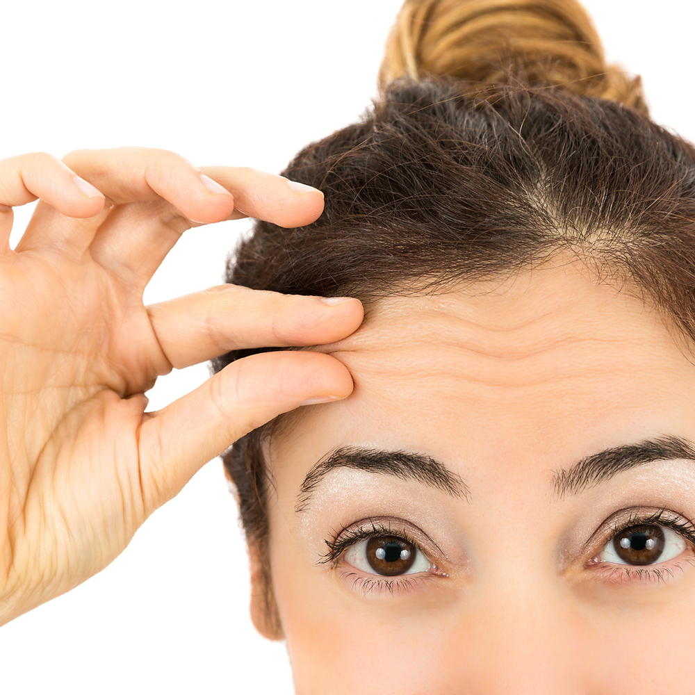 The Four Ways That Foreheads Age