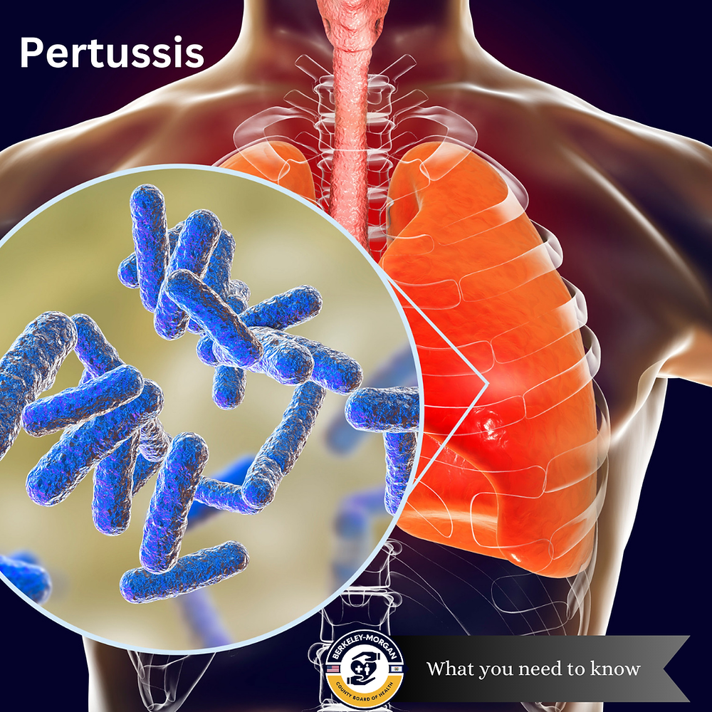09/17/24 Public Health Education Topic: Whooping Cough (Pertussis)