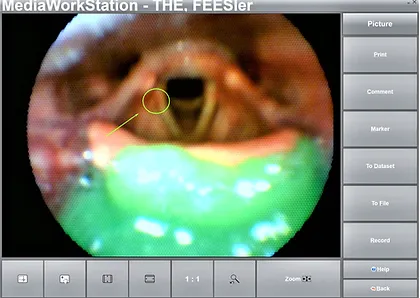What is FEES? | E's Mobile FEES