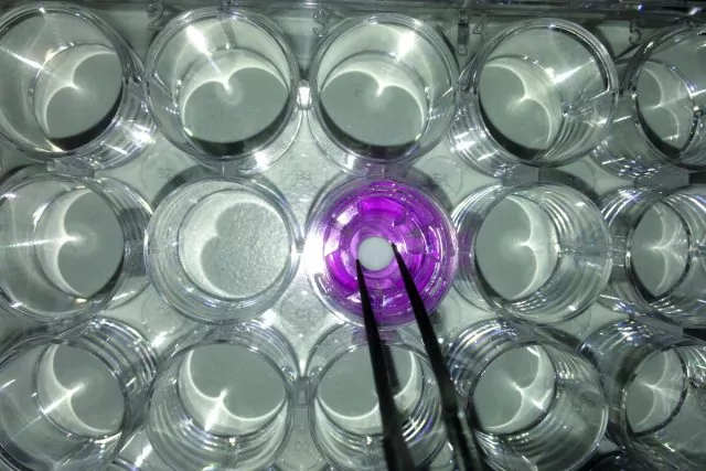 Accessories for Exposure System | YTK Corp