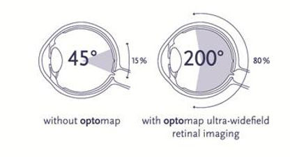 Optomap Digital Retinal Photography | afvc2