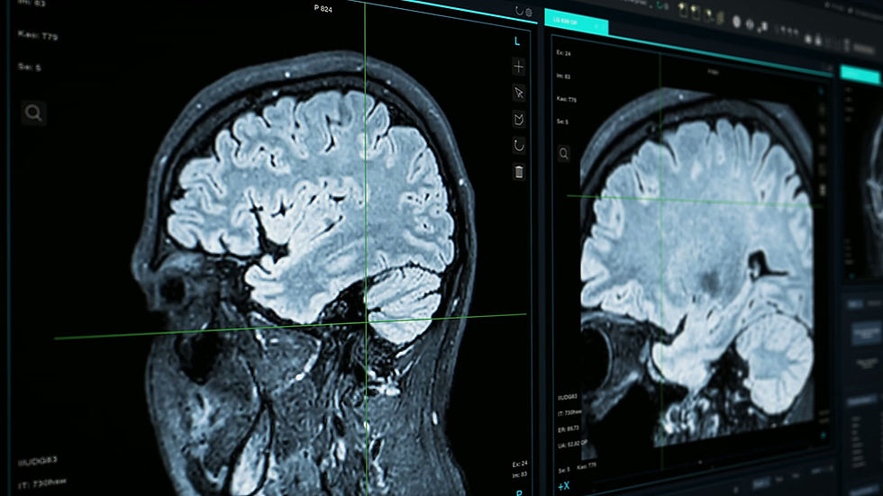 Cortex Neurovascular Neurovascular Subspecialty Care