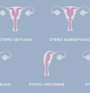 How do I know if I have problems with my ovaries?| BLOG - MATER CLINIC