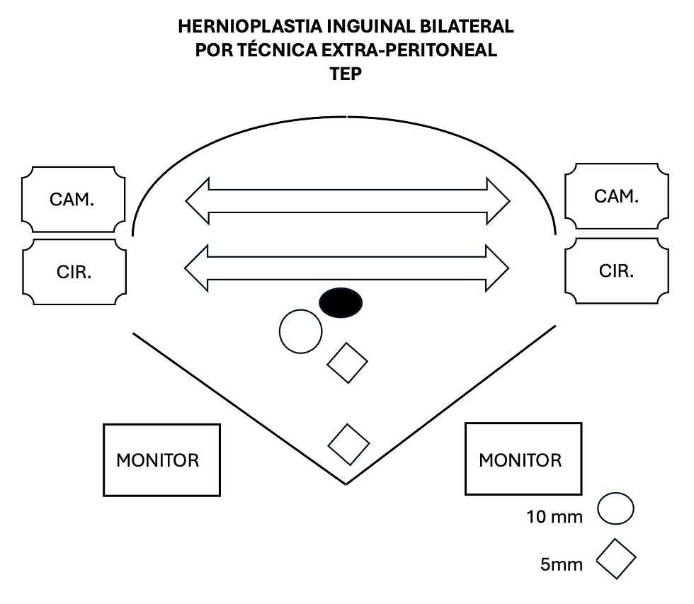 Hernioplastia Inguinal por Videocirurgia - passo a passo parte 2
