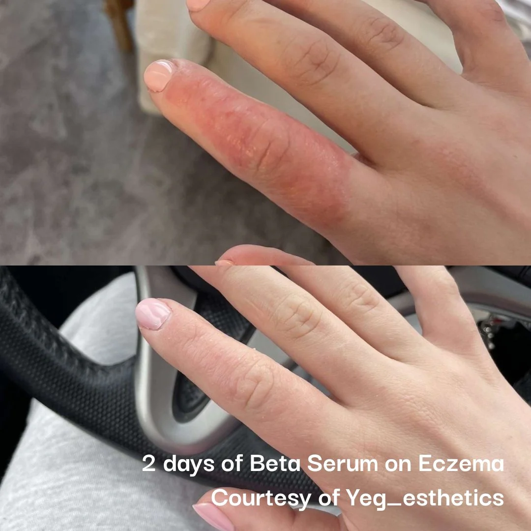 Beta-Glucan Serum | Skyn by Devyn